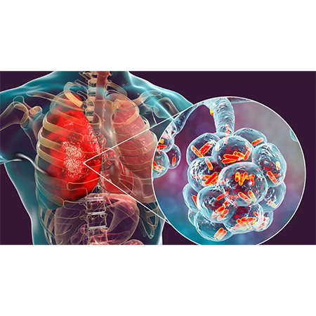 Where and how to install Anti-Legionella valves